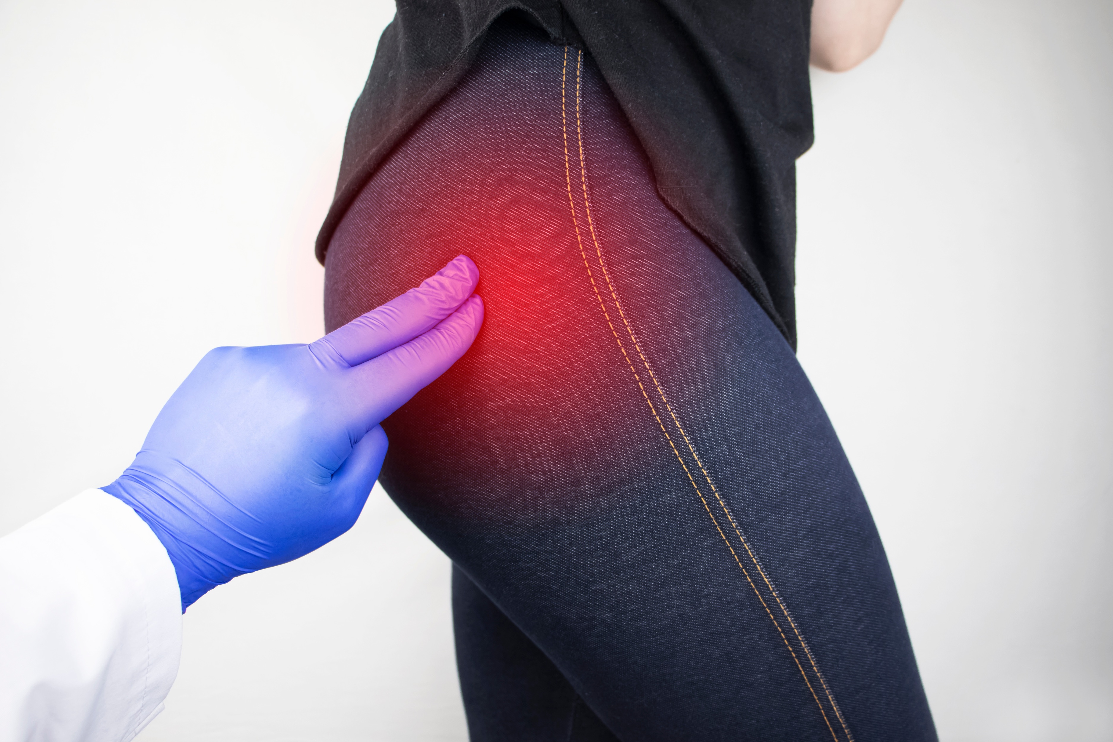 » Terapia manual para el síndrome del piramidal: aliviando el dolor de ...